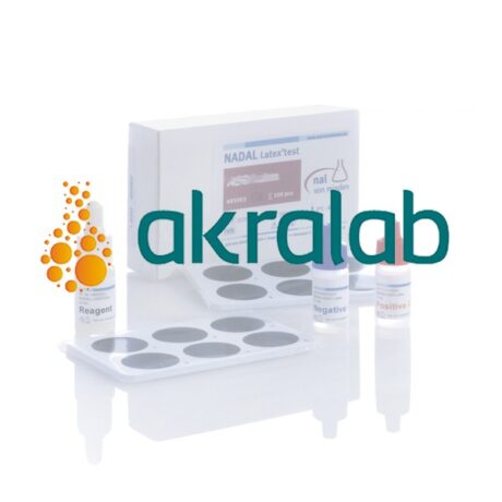 Test VDRL Látex en suero - Akralab
