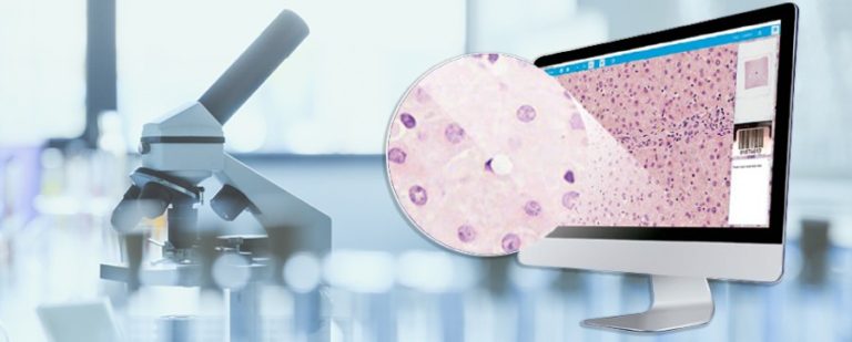 Tips para escoger equipo de Patología Digital | Akralab